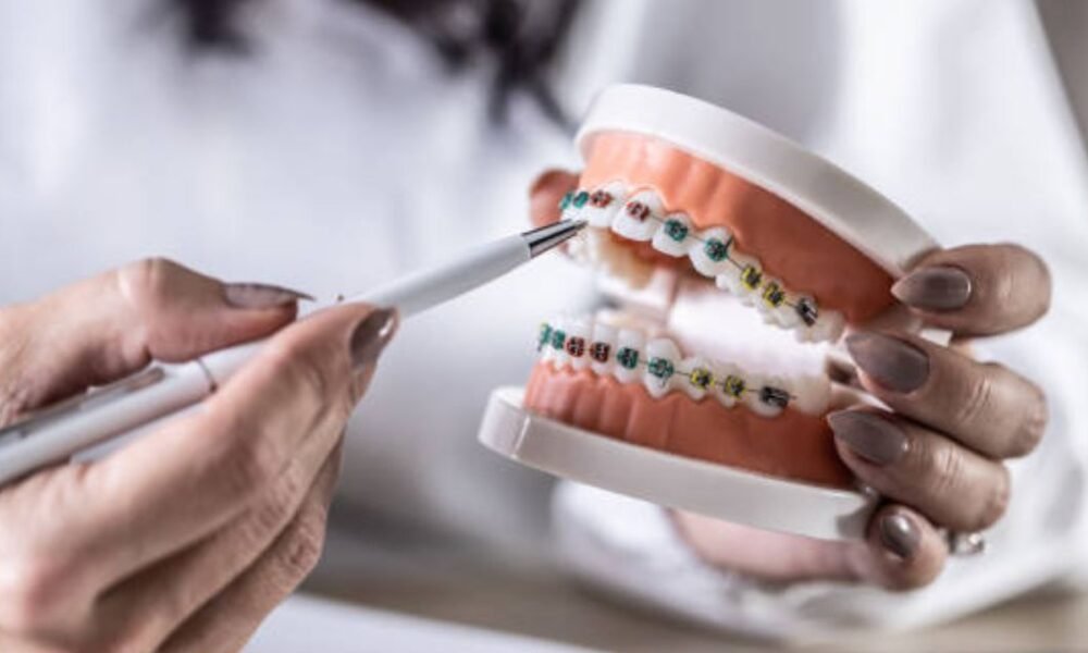 What Are Slacks and How to Wear Them Professionally